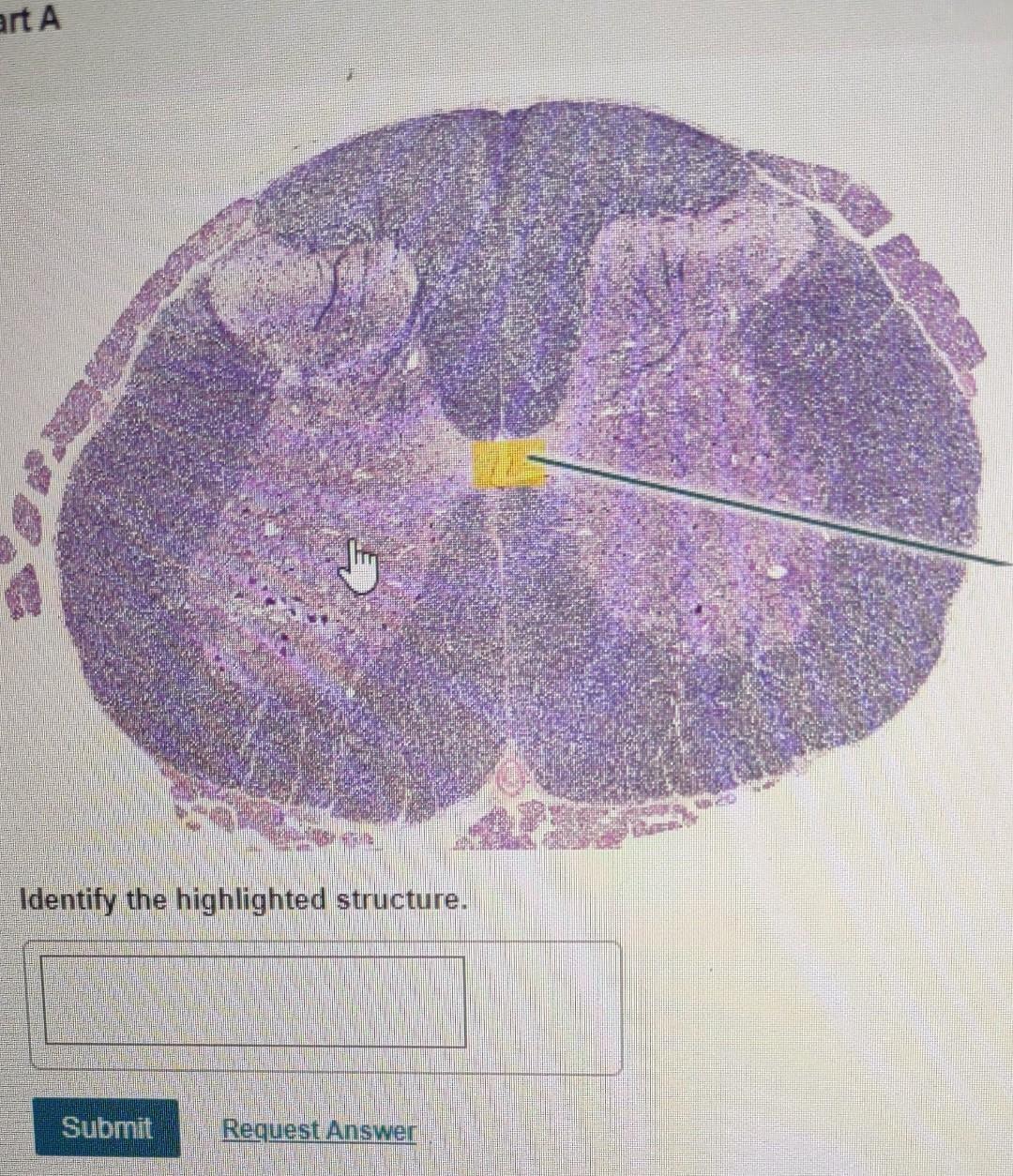 Solved Identify the highlighted structure. | Chegg.com