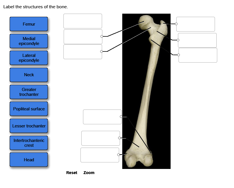 Solved Label the structures of the bone. | Chegg.com