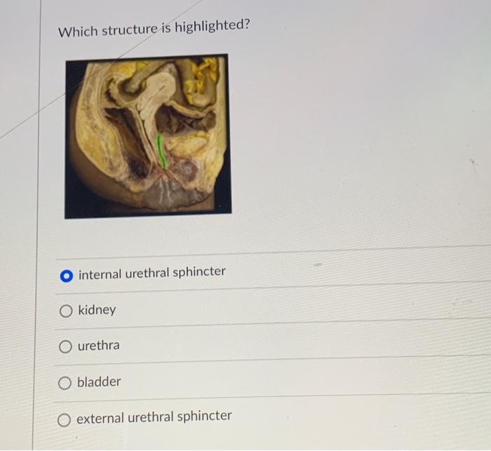 Solved Which structure is highlighted? internal urethral | Chegg.com