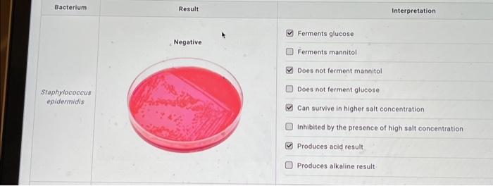 Bacterium Staphylococcus epidermidis Result Negative | Chegg.com