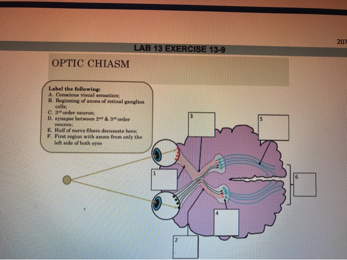 Solved 207 LAB 13 EXERCISE 13-9 OPTIC CHIASM Label the | Chegg.com