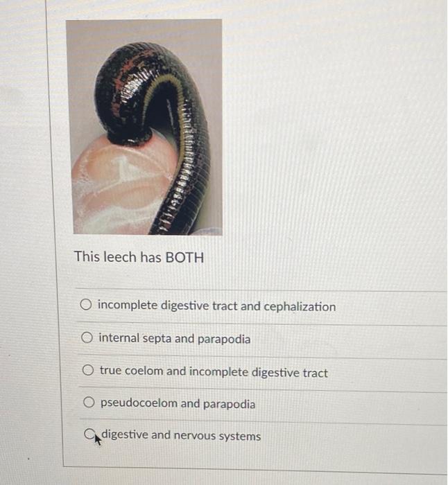 Solved This leech has BOTH O incomplete digestive tract and | Chegg.com