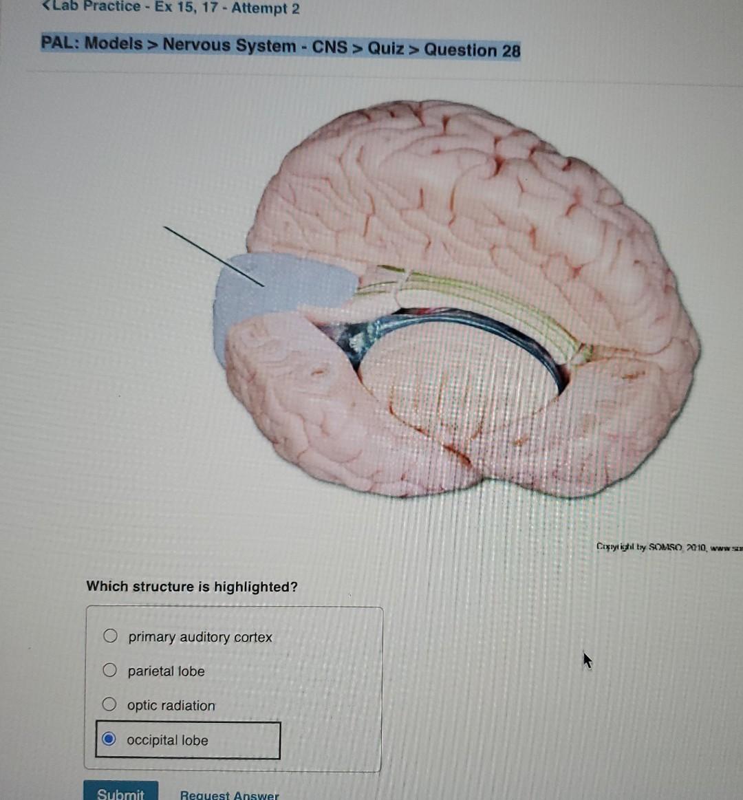 Solved Cirstytikzıl ty SOMASO 2010 , Which structure is | Chegg.com