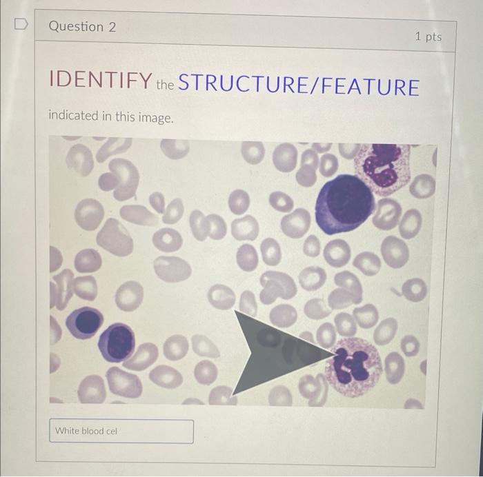 Solved IDENTIFY the FIBER. IDENTIFY the STRUCTURE/FEATURE | Chegg.com Solved IDENTIFY the FIBER. IDENTIFY the STRUCTURE/FEATURE | Chegg.com
