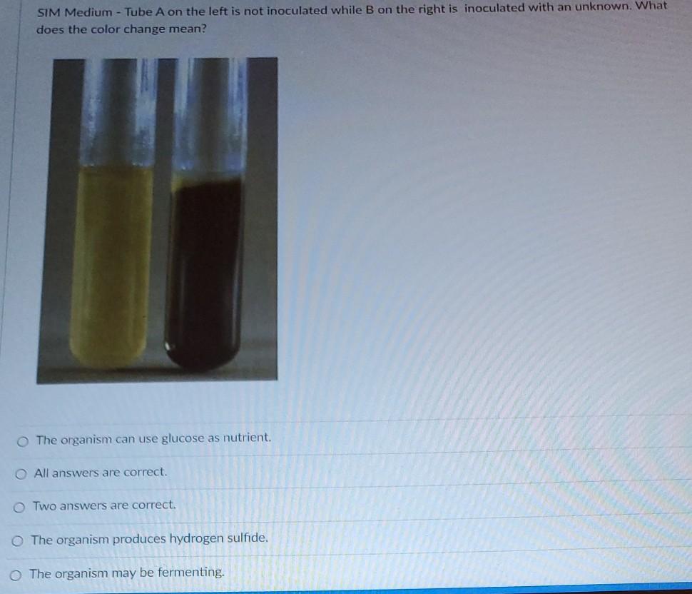 Solved SIM Medium - Tube A on the left is not inoculated | Chegg.com