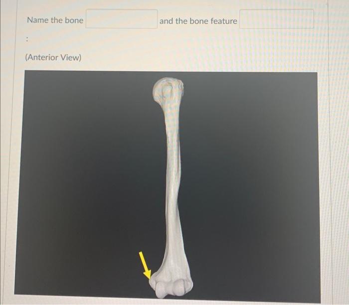 Solved Name the bone and the bone feature (Anterior | Chegg.com