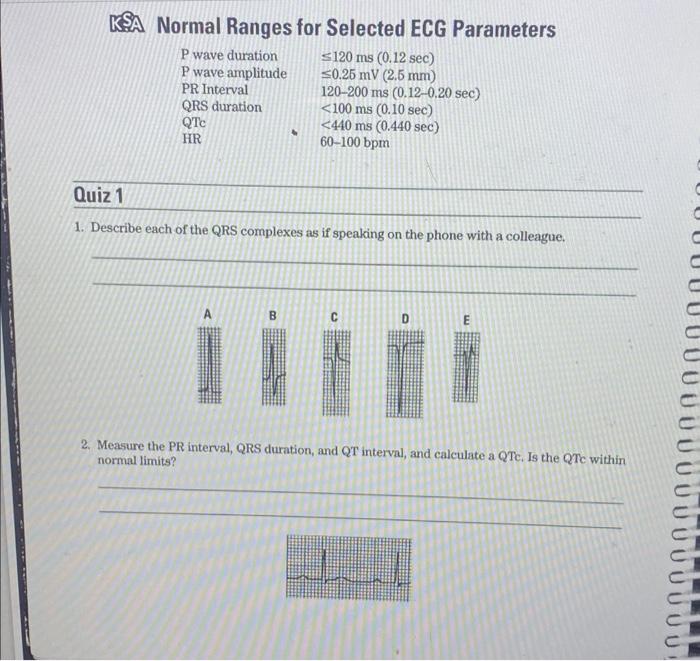 Solved Normal Ranges for Selected ECG Parameters Quiz 1 1. | Chegg.com
