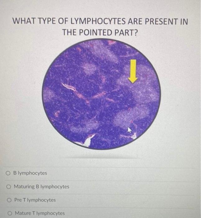 Solved IDENTIFY THE POINTED CELL. O Chief cell O Chromophobe | Chegg.com