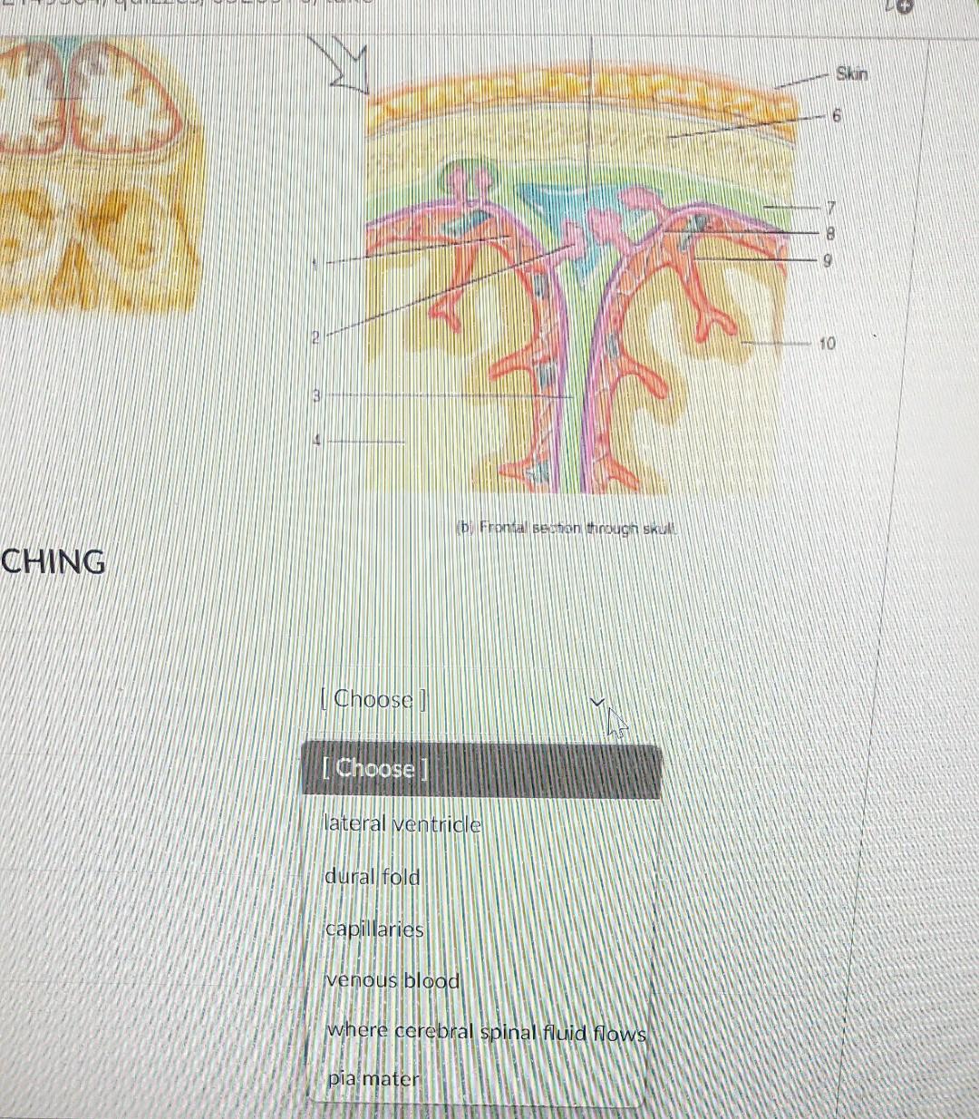 Solved Neurulation Neural plate Neural fold Notochord | Chegg.com