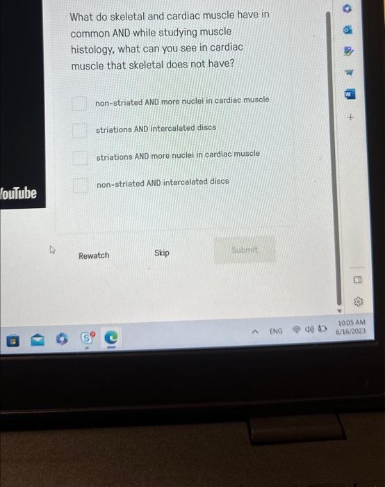 Solved What do skeletal and cardiac muscle have in common | Chegg.com