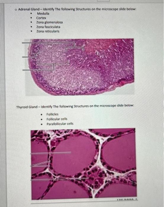 Solved Adrenal Gland - identify The following Structures on | Chegg.com