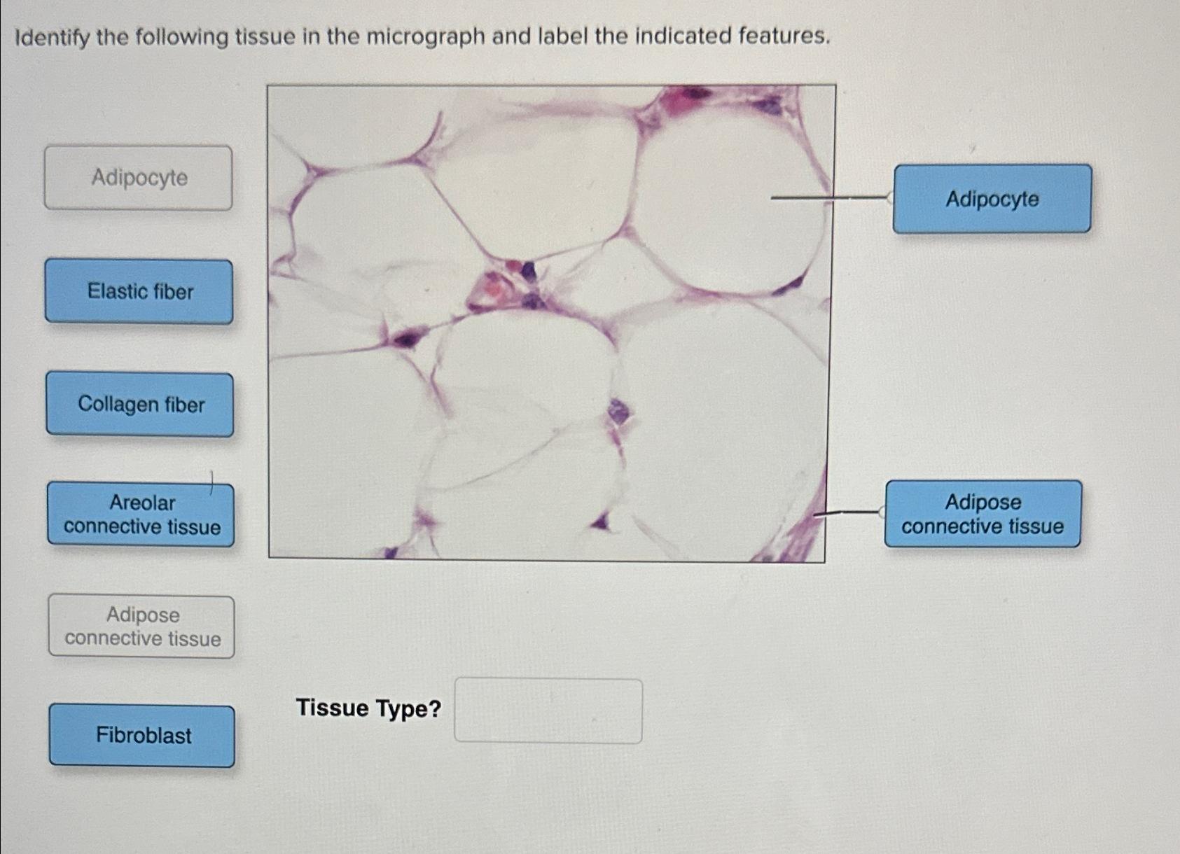 Solved Identify the following tissue in the micrograph and | Chegg.com Solved Identify the following tissue in the micrograph and | Chegg.com