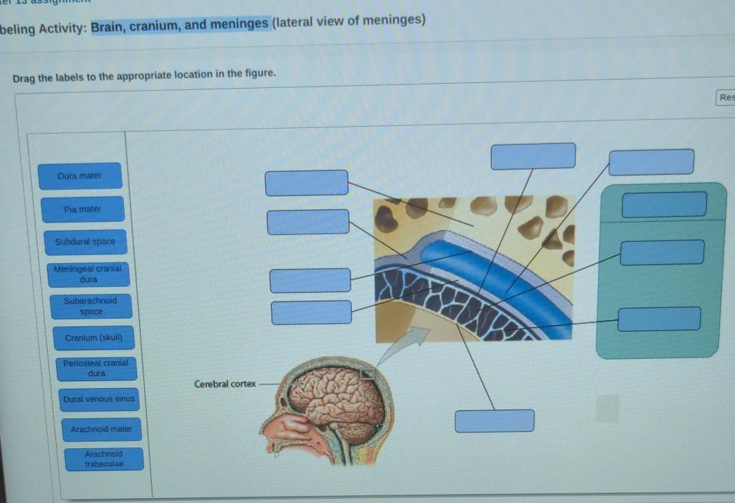 Solved beling Activity: Brain, cranium, and meninges | Chegg.com