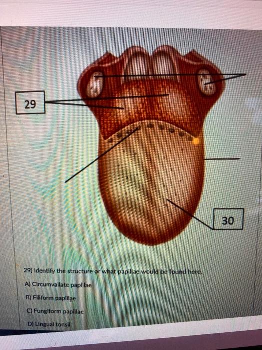 Solved 29 30 29) Identify the structure or what papillae | Chegg.com