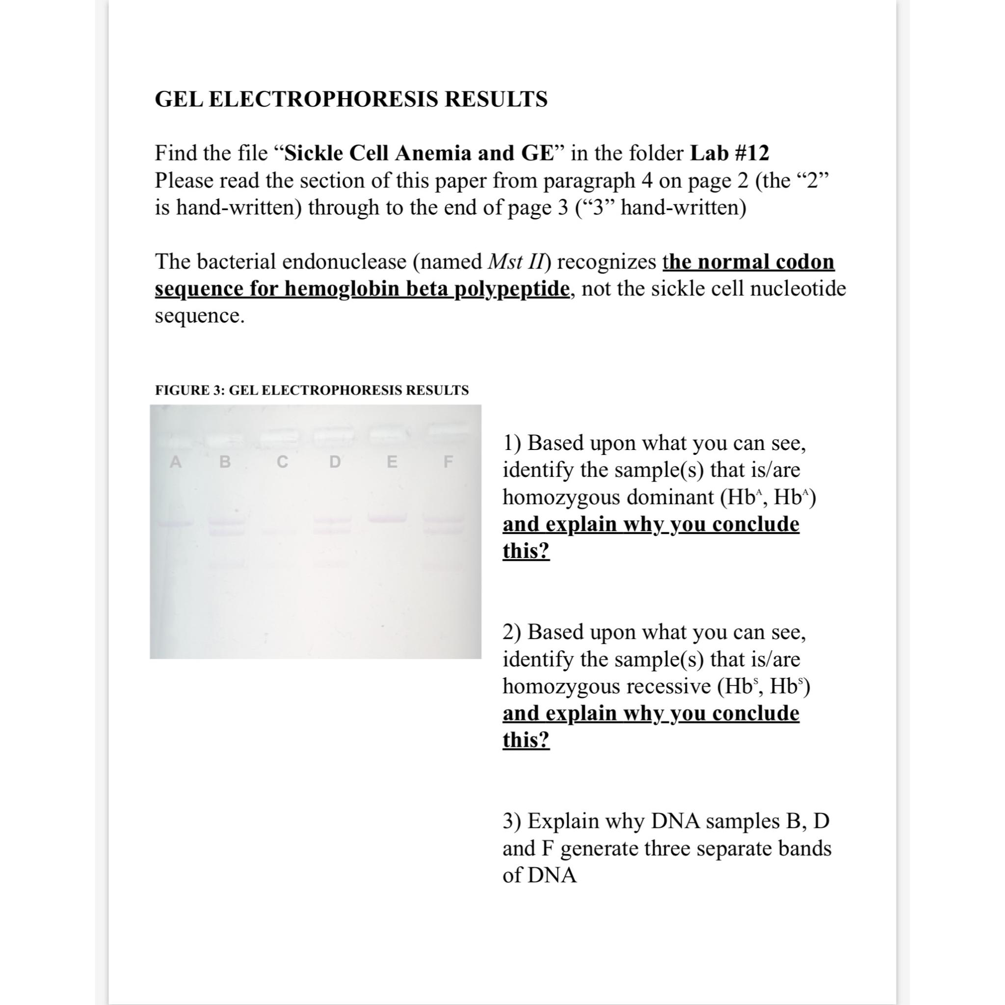Solved GEL ELECTROPHORESIS RESULTSFind the file "Sickle Cell | Chegg.com