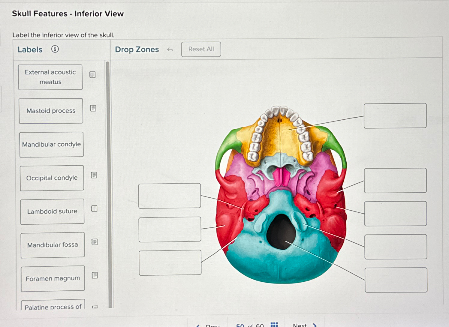Solved Skull Features - ﻿Inferior ViewLabel the inferior | Chegg.com