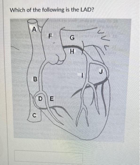 Solved Which of the following is the LAD? | Chegg.com