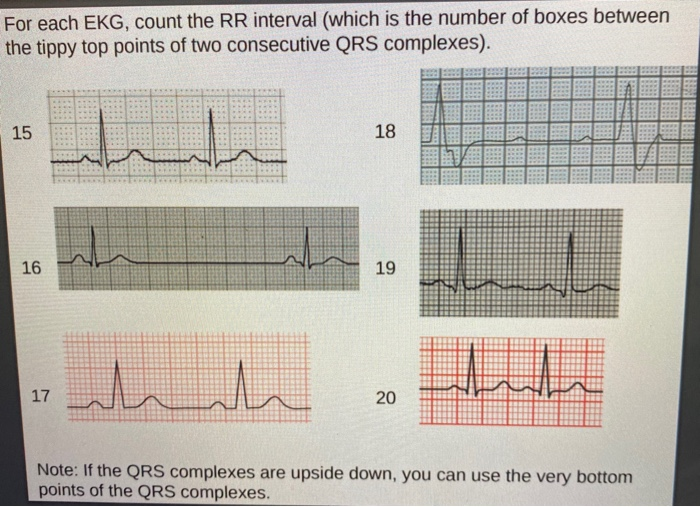 Solved For each EKG, count the RR interval (which is the | Chegg.com