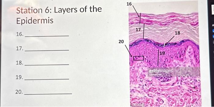 Solved Station 6: Layers of the Epidermis 16. 17. 18. 19. | Chegg.com