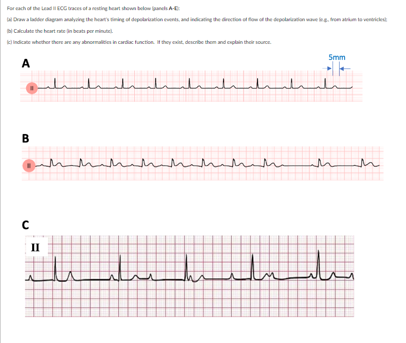Solved For each of ﻿the Lead II ﻿ECG traces of ﻿a resting | Chegg.com