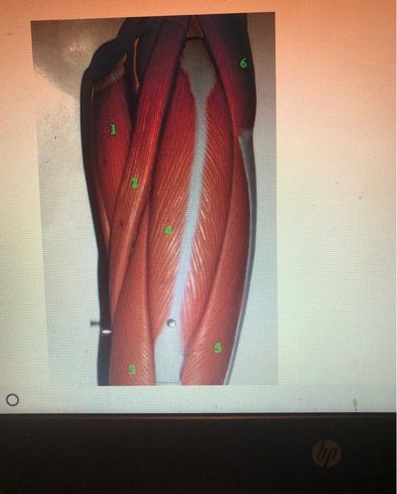 Solved 6 V Rectus femoris 1. Muscle Label #1 Adductor | Chegg.com