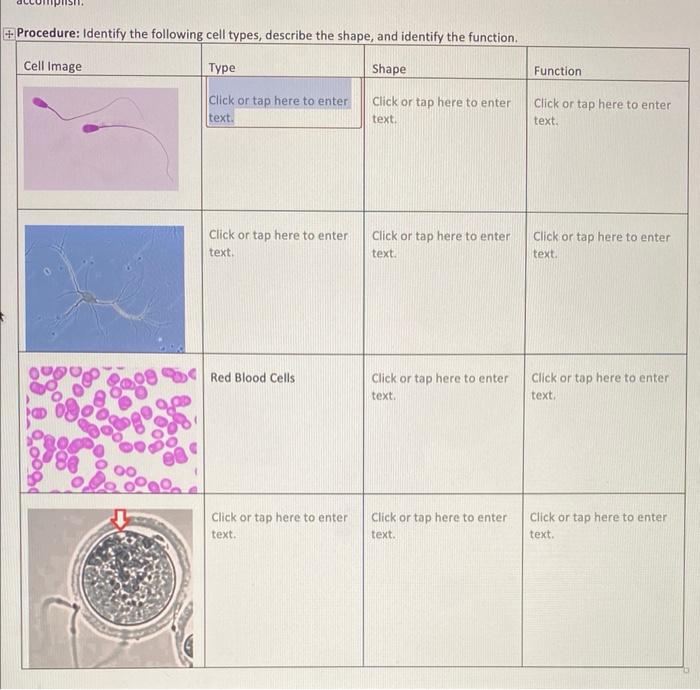 Solved + Procedure: Identify the following cell types, | Chegg.com