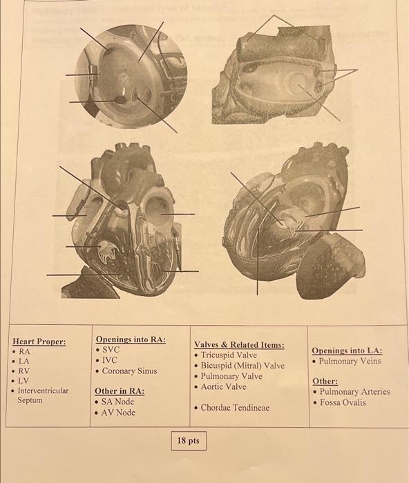 Solved Heart Proper: • RA • LA • RV .LV • Interventricular | Chegg.com