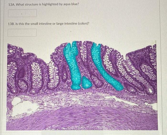 Solved 13A. What structure is highlighted by aqua blue? 13B. | Chegg.com