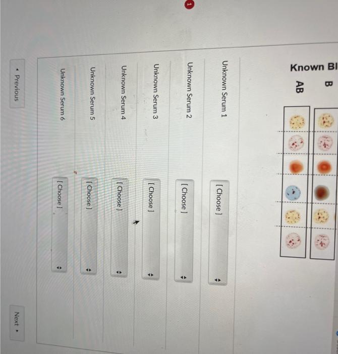 Solved Blood typing involves antibody antigen interactions | Chegg.com