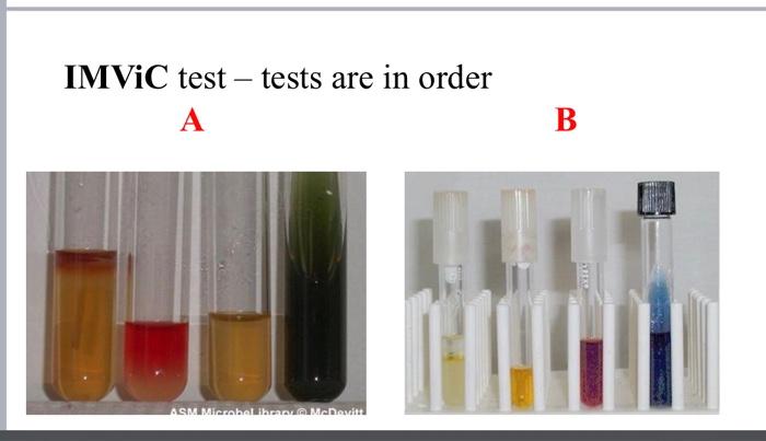 Solved А Exercise 30 Results Starch Agar Plate Casein Agar | Chegg.com
