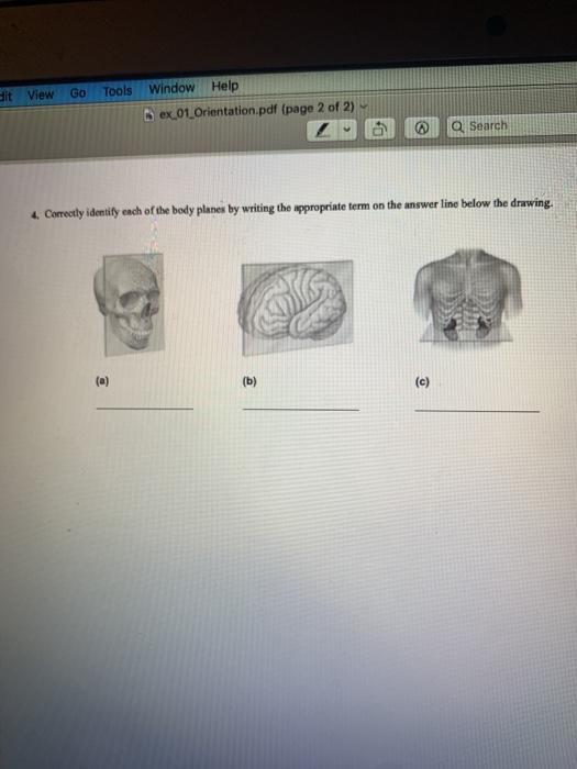 Solved Region 1. Describe completely the standard human | Chegg.com