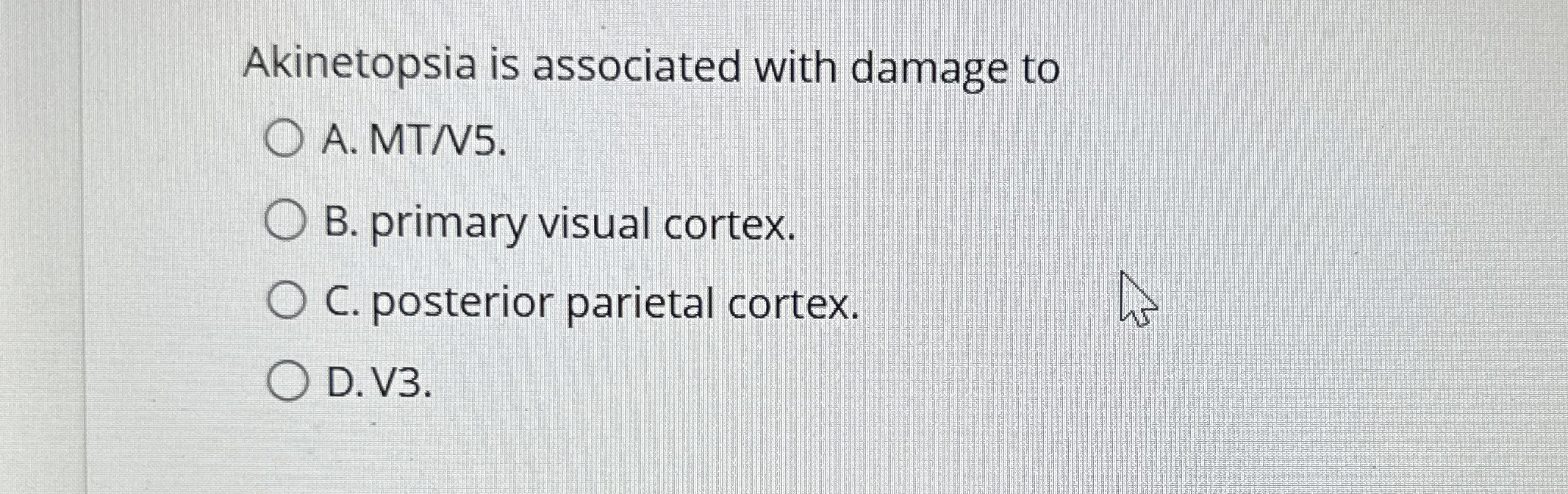 Solved Akinetopsia is associated with damage toA. ﻿MT/N5.B. | Chegg.com