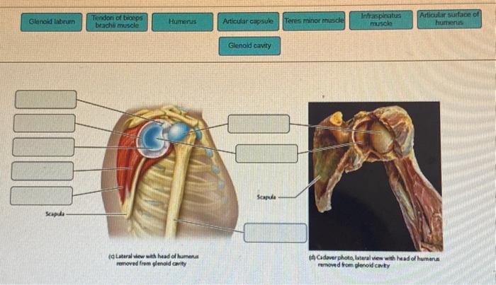 Solved Genoid latrum Tenderi of biocps Articular capsule | Chegg.com