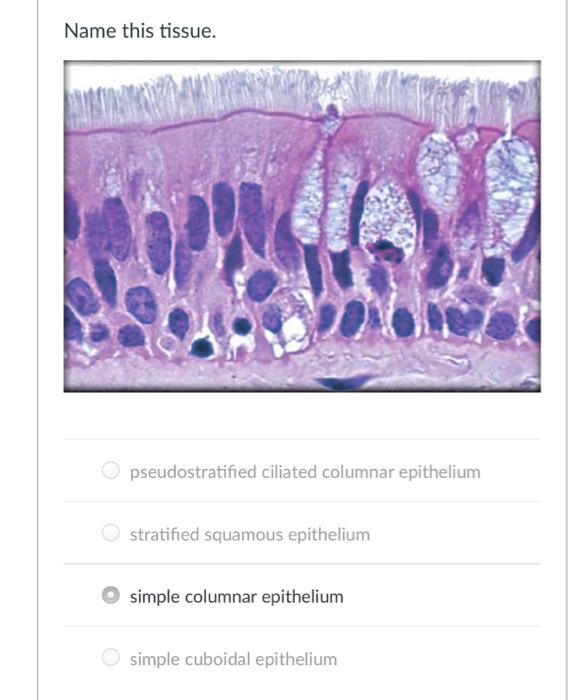 Solved Name this tissue. pseudostratified ciliated columnar | Chegg.com