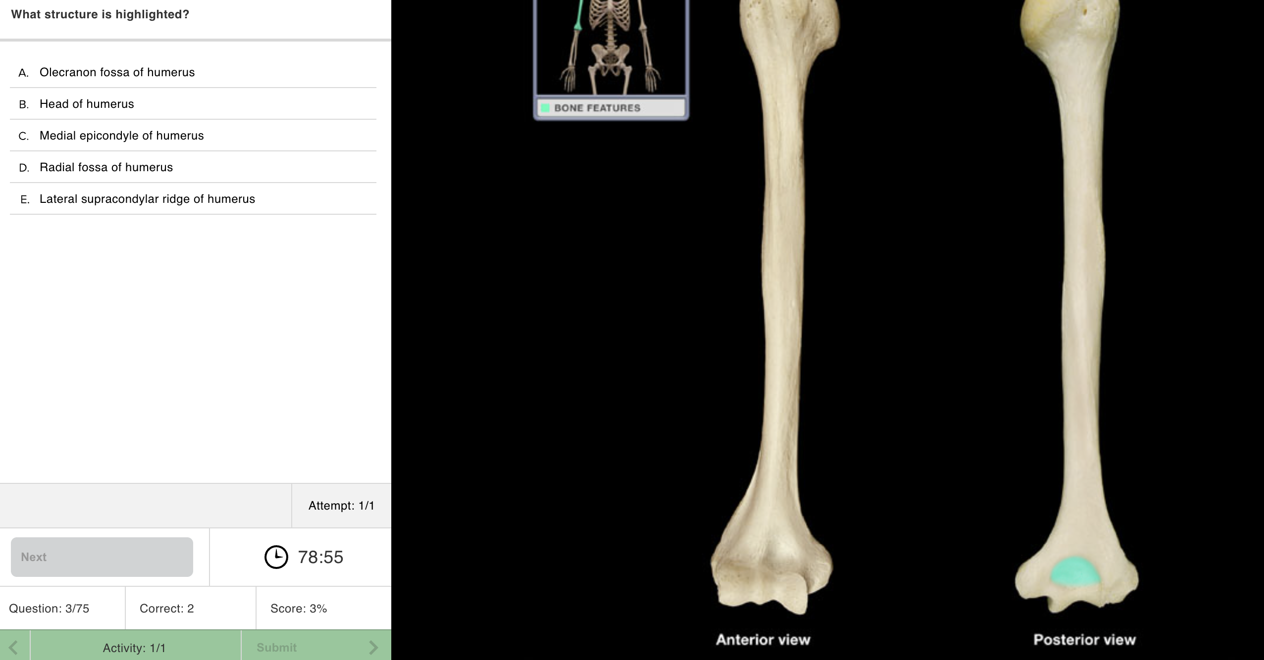 Solved What structure is highlighted?A. ﻿Olecranon fossa of | Chegg.com