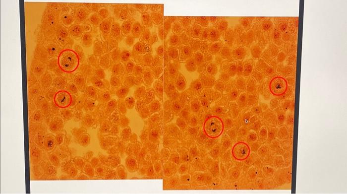 Cell Crcle "Divide the number of cells identified in | Chegg.com