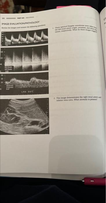 MAGE EVALUATIONPATHOLOGY 2. This imabe demanstrans | Chegg.com