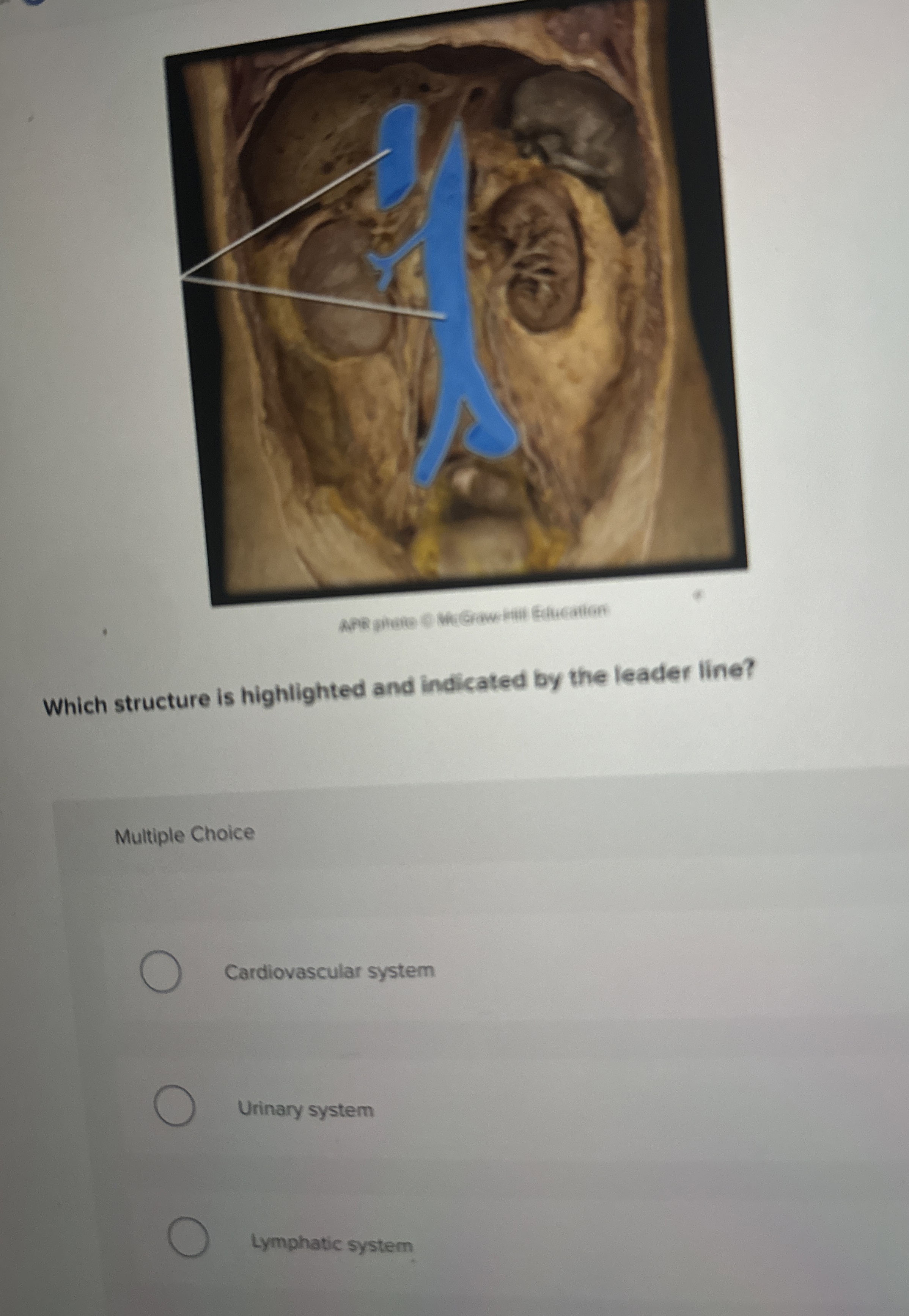 Solved Which structure is highlighted and indicated by the | Chegg.com