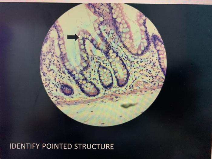 Solved IDENTIFY POINTED STRUCTURE WHAT STRUCTURE IS LINED | Chegg.com Solved IDENTIFY POINTED STRUCTURE WHAT STRUCTURE IS LINED | Chegg.com