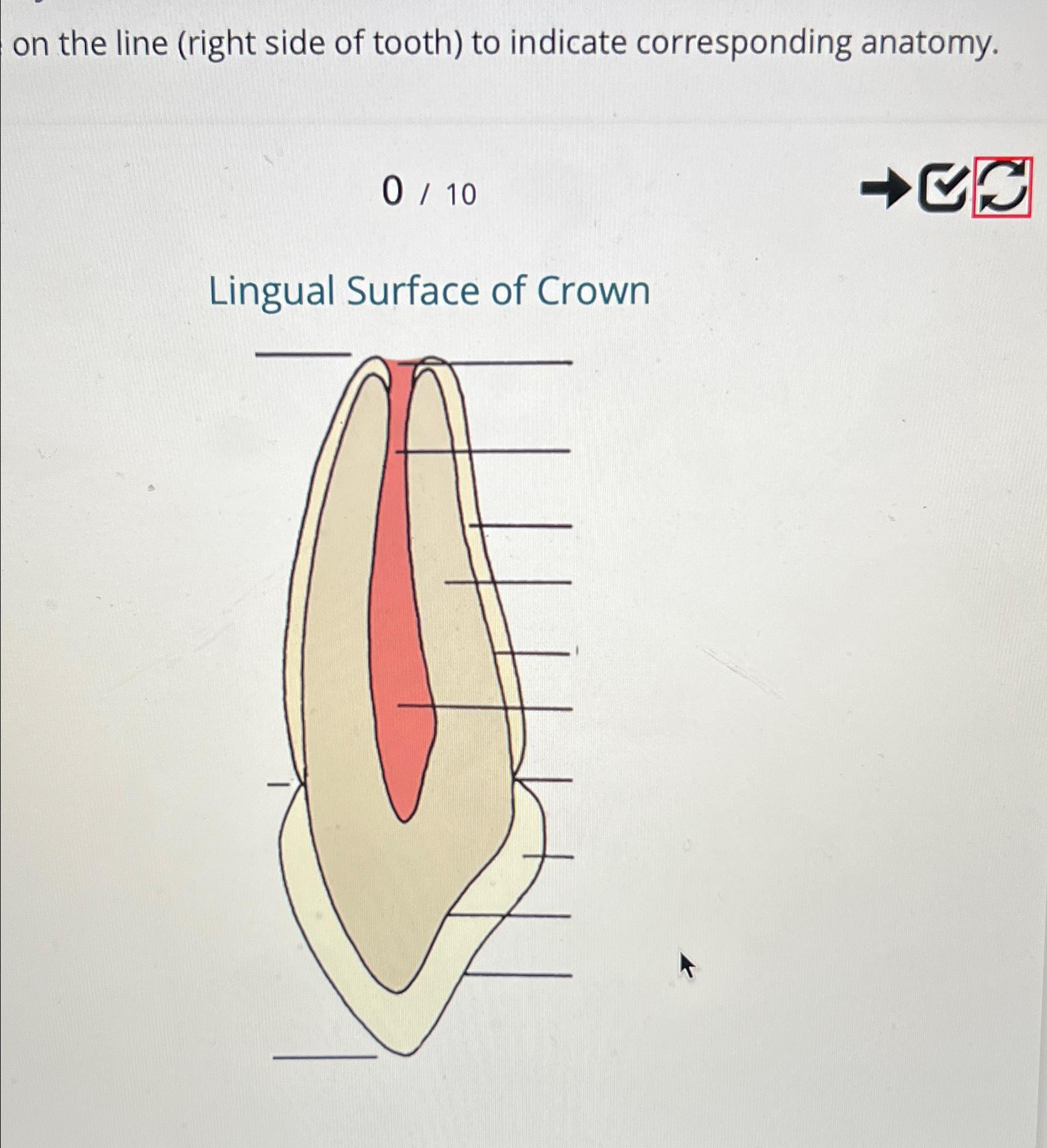 Solved on the line (right side of tooth) ﻿to indicate | Chegg.com