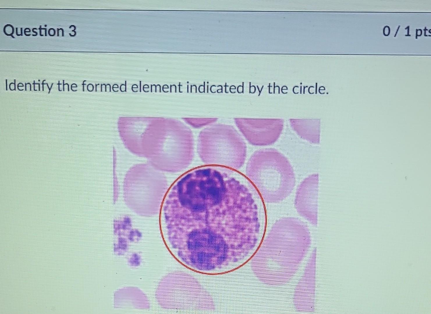 Solved Identify the formed element indicated by the circle. | Chegg.com