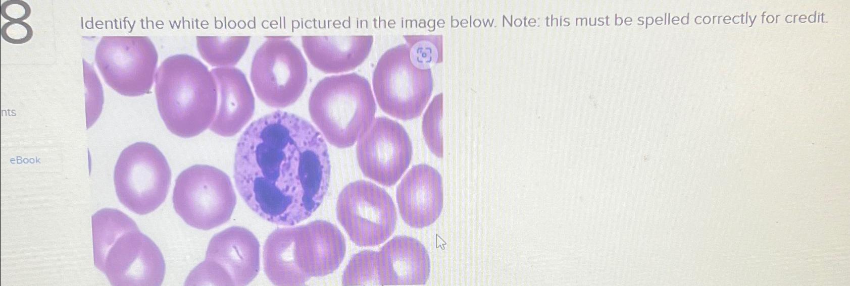 Solved Identify the white blood cell pictured in the image | Chegg.com
