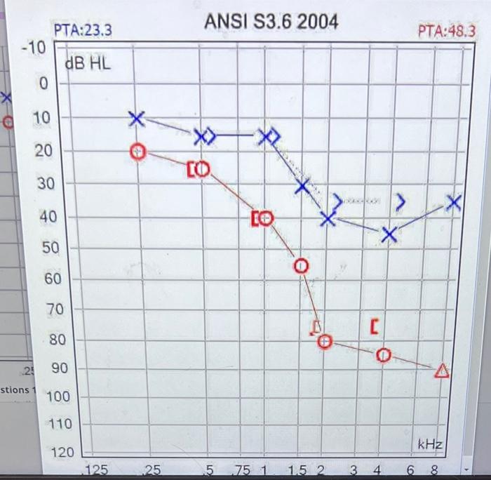 Solved (Refer to the audiogram for this question) | Chegg.com