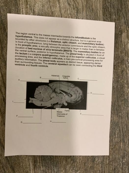 Solved Dorsal and Lateral Structures The largest structure | Chegg.com