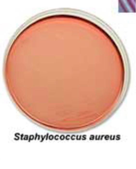 Solved what do the results of Staphylococcus epidermidis | Chegg.com