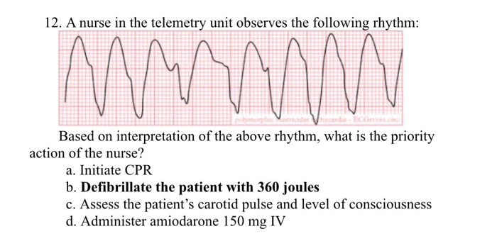 Solved 12. A nurse in the telemetry unit observes the | Chegg.com