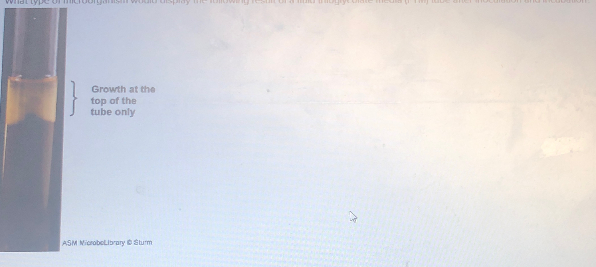 Solved Growth at the top of the tube onlyASM MicrobeLibrary | Chegg.com