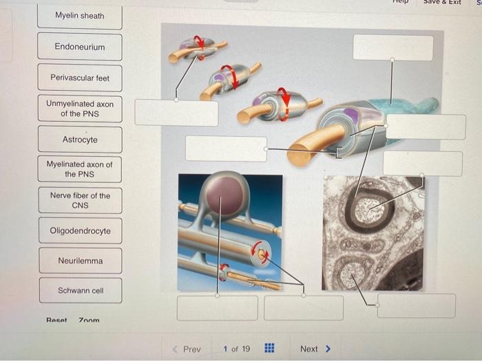 Solved HOW aveo Exit Myelin sheath Endoneurium Perivascular | Chegg.com
