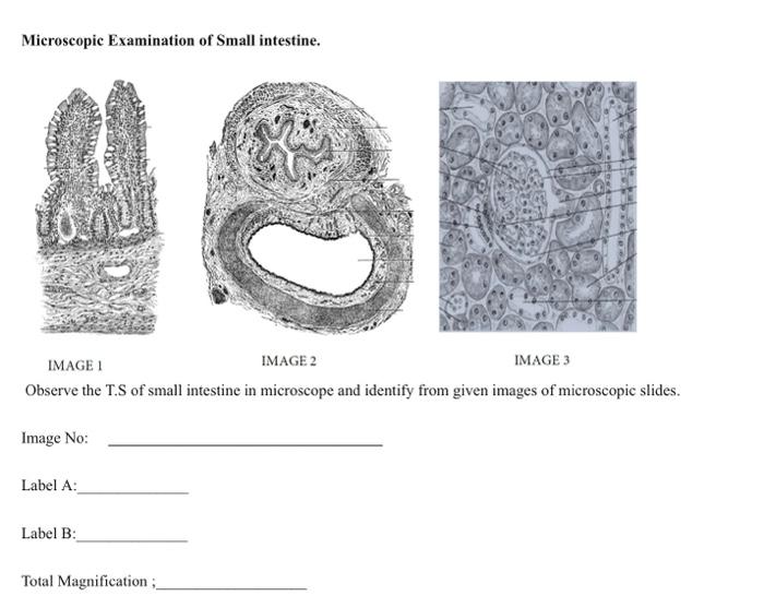 Solved Microscopic Examination of Small intestine. IMAGE 1 | Chegg.com