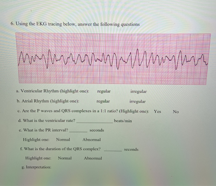 Solved 6. Using the EKG tracing below, answer the following | Chegg.com
